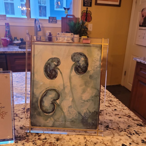 Transplant Kidney Watercolor Print - Anatomical Kidney Art - Nephrology ...