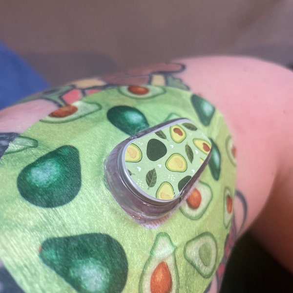 Dexcom G7 Stickers | decorate Your Devices | Girls With Gadgets ...