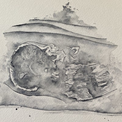 Embryo Art Ivf Painting Embaby Art Hand-painted Nursery Decor Fertility ...