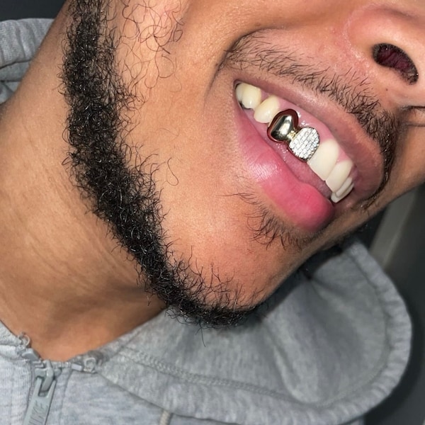 Gold Window/open Face Grillz Tooth Cap Worldwide Shipping White, Rose ...