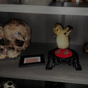 Lobotomy Shadowbox - Etsy