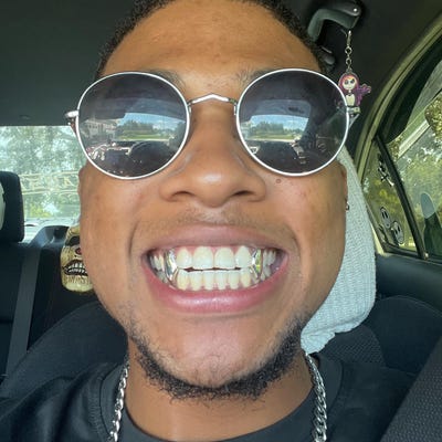 Handmade Custom Dental Gold Top Fangs With Bottom Wolf Style Grillz - Etsy