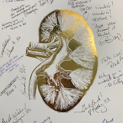 Human Kidney II Anatomy Gold Foil Print, Gold Print, Kidneys Anatomy ...