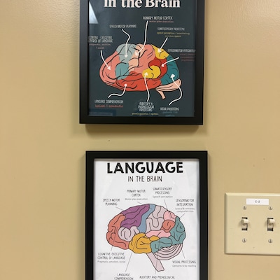 How Trauma Affects the Brain, Human Brain Poster, Brain Anatomy Poster ...