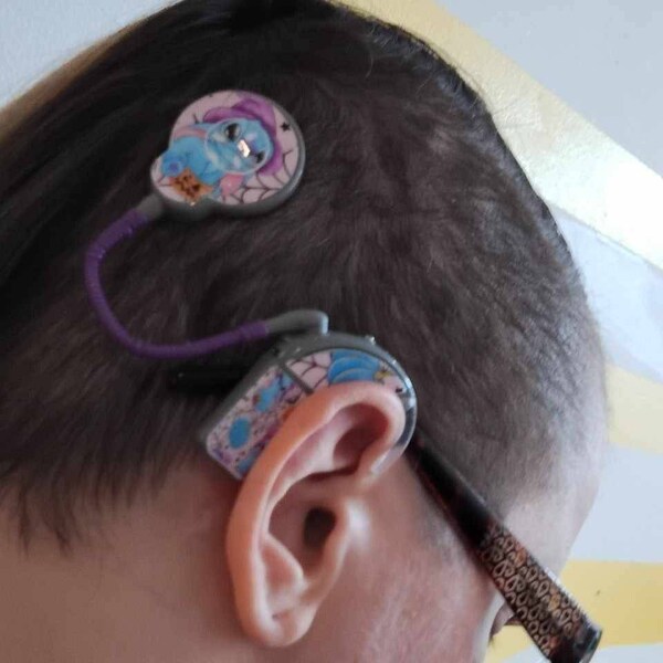 Cochlear Implant Skins Cochlear Implant Stickers - Etsy