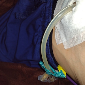 Tube Clips to Help Hold Medical Tubing and Keep Them Separated-chemo ...
