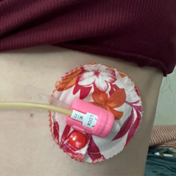 G-tube Pads, Mic-key Button Feeding Tube Pads, AMT Button Cover: Lime ...