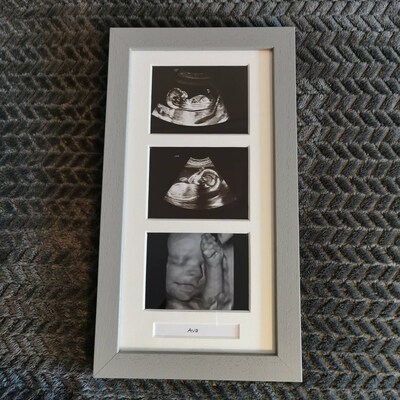 Baby Scan Photo Frame Multi Aperture Frame for Three Scan Sized Photos ...