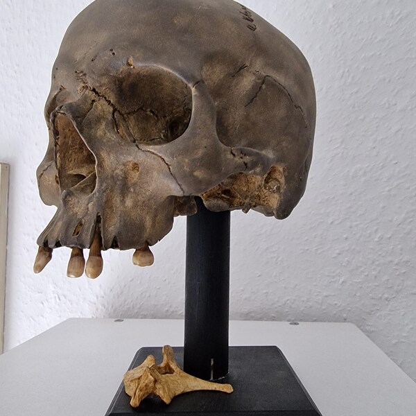 Human Skull Stand Skull Display Decorative Skull Stand Oddities Display ...