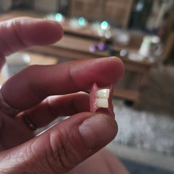 Chipped Tooth Filling Kit Diy Fix Broken Teeth Emergency Repair Crafting Kit Composite Filling