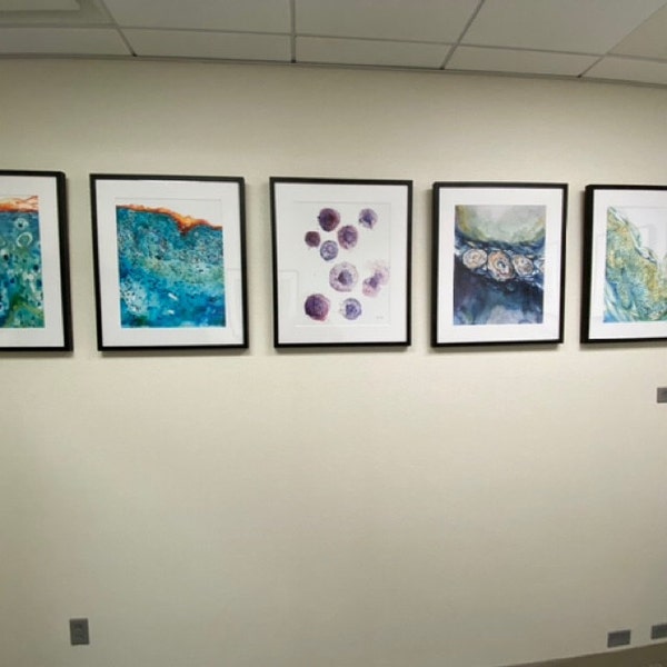 Cross Section of the Skin Watercolor Art Print - Integumentary System ...