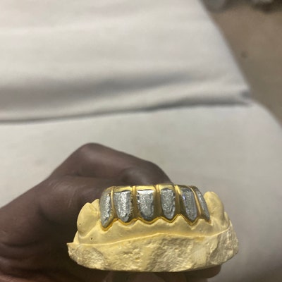 Custom Grillz 10pc on 10pc Solid Gold - Etsy