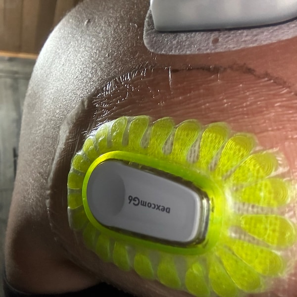 Flexible Dexcom G6 Cover - Holds and Protects Sensor and Patch ( Over ...