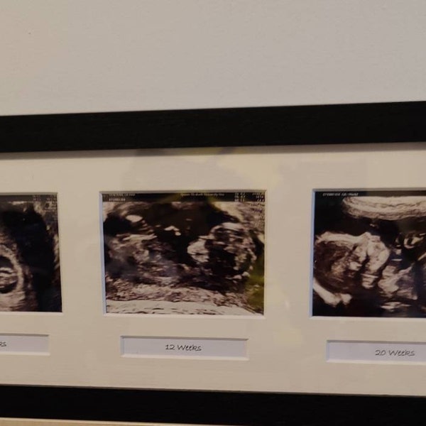 Baby Scan Photo Frame - Multi Aperture Frame for Three Scan Sized ...