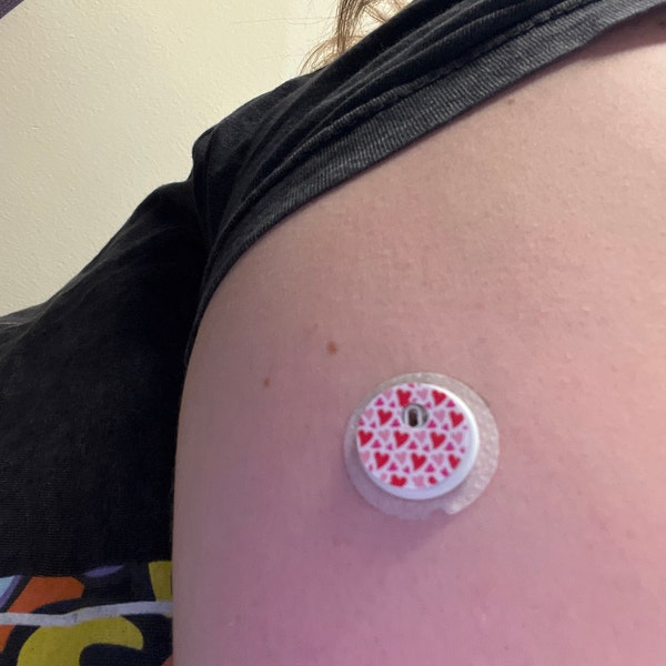 Tandem T:slimx2 Insulin Pump Stickers, Valentines, Hearts - Etsy