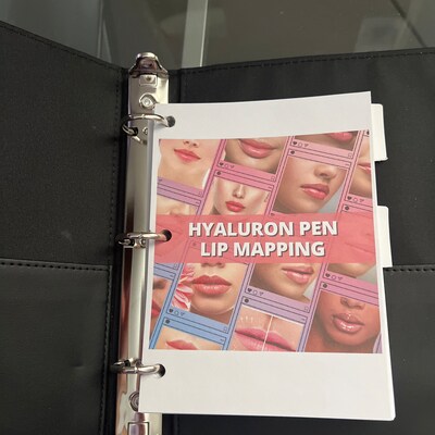 Hyaluron Pen Lip Mapping, Lip Map, Lip Mapping Techniques, Russian Lip ...