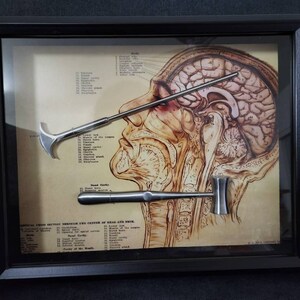 Infant & Child Embalming Trocar / Drain Tube - Etsy