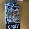 Custom X-ray Markers WITH CASING - Etsy