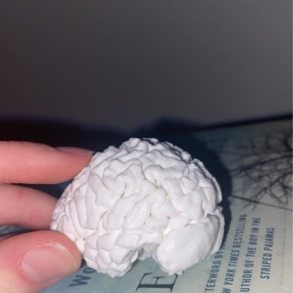 NEURON 3D MODEL | 3D Printed Brain Cell With Internal Cell Body ...