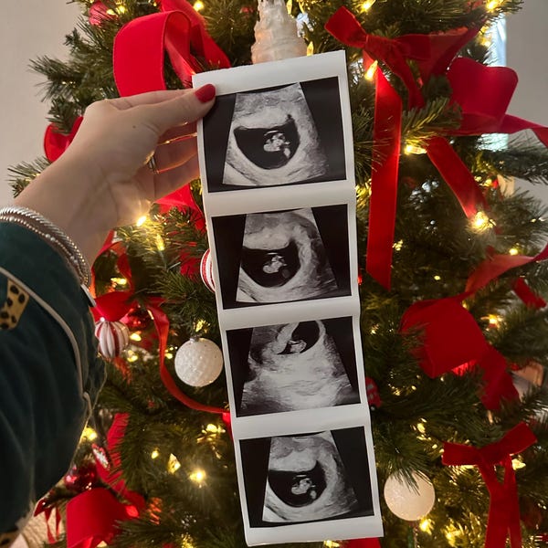 Traditional Ultrasound Strip - Upload Your Digital Images - Etsy