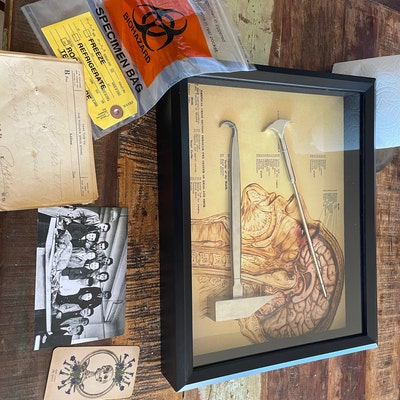 BESTSELLER Lobotomy Shadowbox Display Large - Etsy
