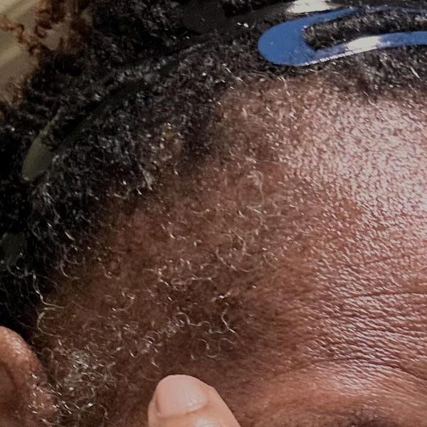 Thick and Full Edges & Hair Growth Oil Wholesale / Extra Strength Hair ...