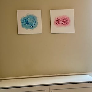 Custom IVF Art Embryo Watercolor Personalized Pregnancy Gift Nursery ...