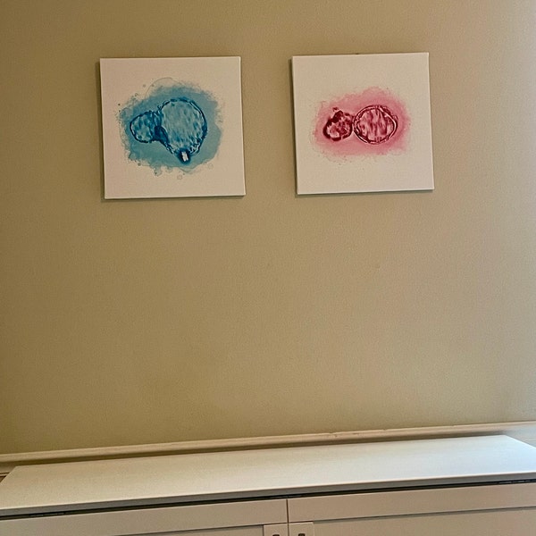 Custom IVF Art Embryo Watercolor Personalized Pregnancy Gift - Nursery ...