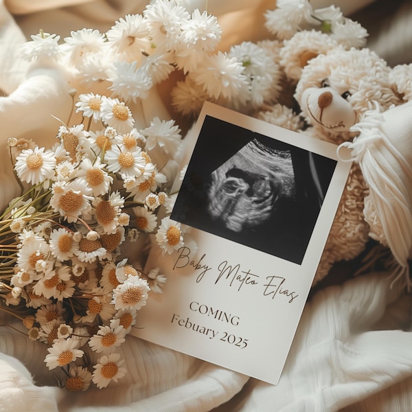 Daisy Flower Pregnancy Announcement Digital Download Boho Baby ...