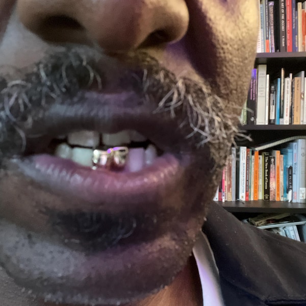 10K Gold Custom Grillz: Two Front Teeth Double Cap - Etsy