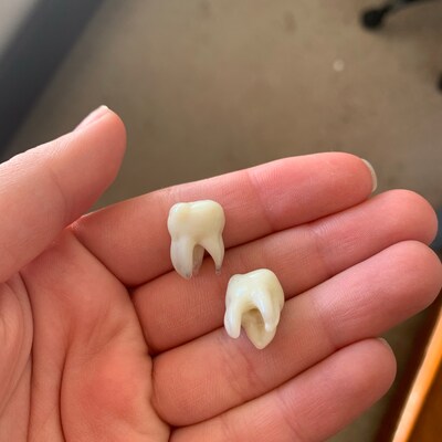 Glass Root Tooth Beads, Molar Beads, Dentist Gift Prank, Teeth Beads ...