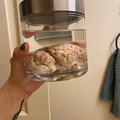 Lobotomy Shadowbox - Etsy