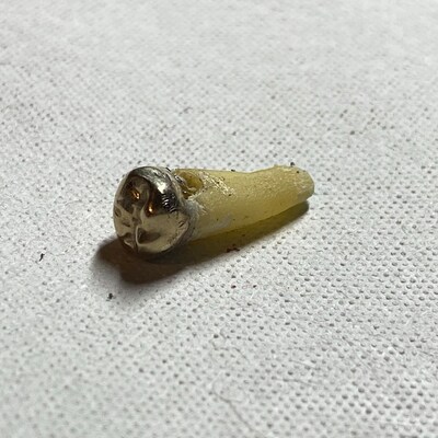 10 Real Human Teeth molars, Premolars, & Anteriors - Etsy