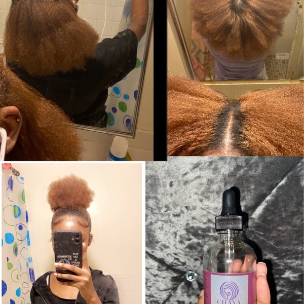 Xtreme Hair Growth Oil - Etsy