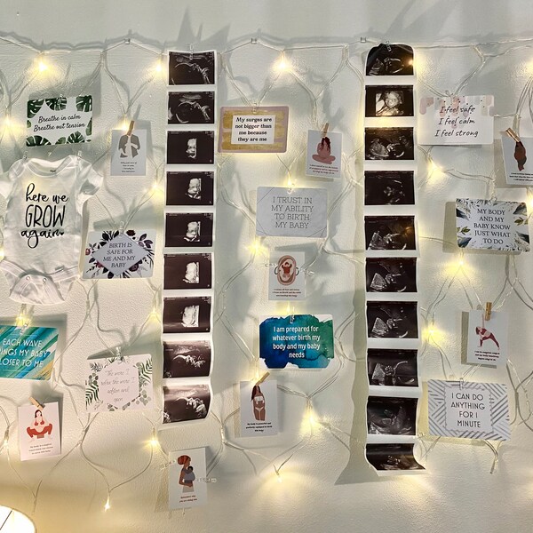 Umbilical Cord Tie a Gentle Alternative to Plastic and a Beautiful ...