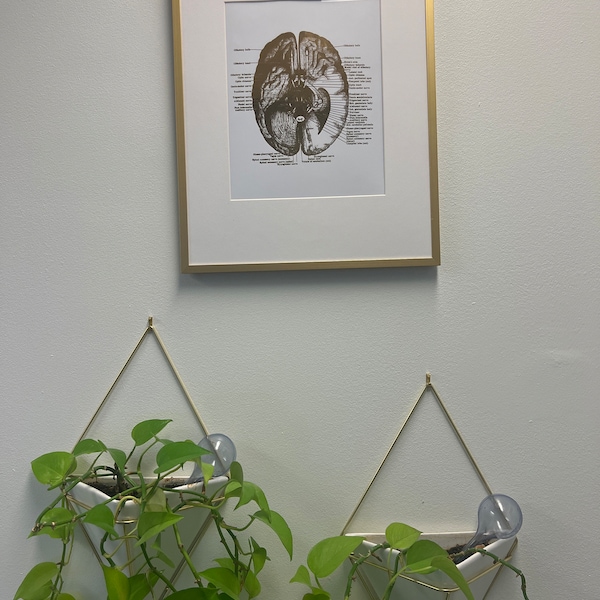 Human Brain Anatomy Medical Student Gift Foil Print - Doctors Office ...