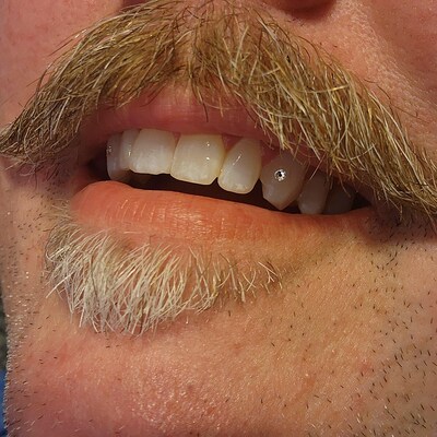 Swarovski Crystal AB Tooth Gems Aurora Borealis Wholesale Tooth Jewelry ...