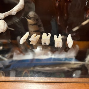 One Real Human Tooth Pendant Necklace - Etsy