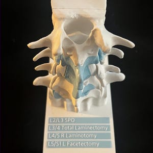 Demoscope: Endoscopy/colonoscopy Device Model for Teaching - Etsy