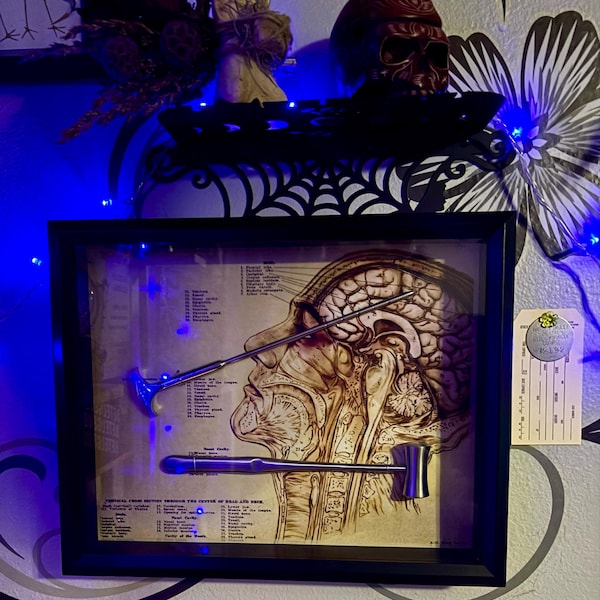BESTSELLER! Lobotomy Shadowbox Display Large - Etsy