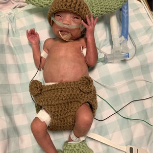 NICU Little Frog Micro Preemie Outfit With Overalls Fits 2 - Etsy