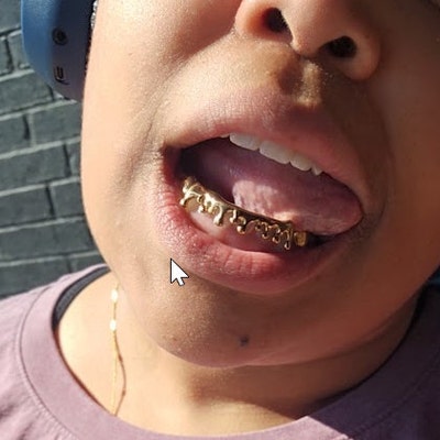 The BEST Mold Kits for Grillz Mold Impression Kit for Custom Grillz ...