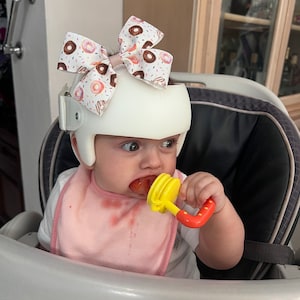 SETS OF 3 BOWS Cranial Helmet Bow Doc Band Bow Starband Bow - Etsy