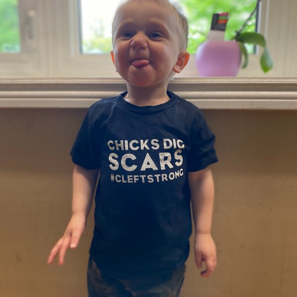 Chicks Dig Scars / Cleft Palate / Cleft Strong - Etsy