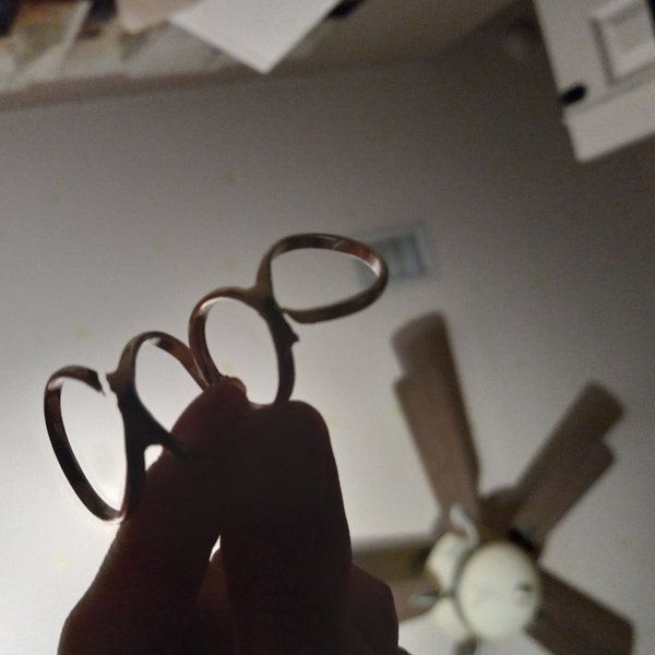 Arthritis MCP Hyperextension Splint Ring,full Hand Support Splint,thumb ...