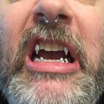 Handmade Custom .925 Sterling Silver Top Fangs With Bottom Wolf Style ...