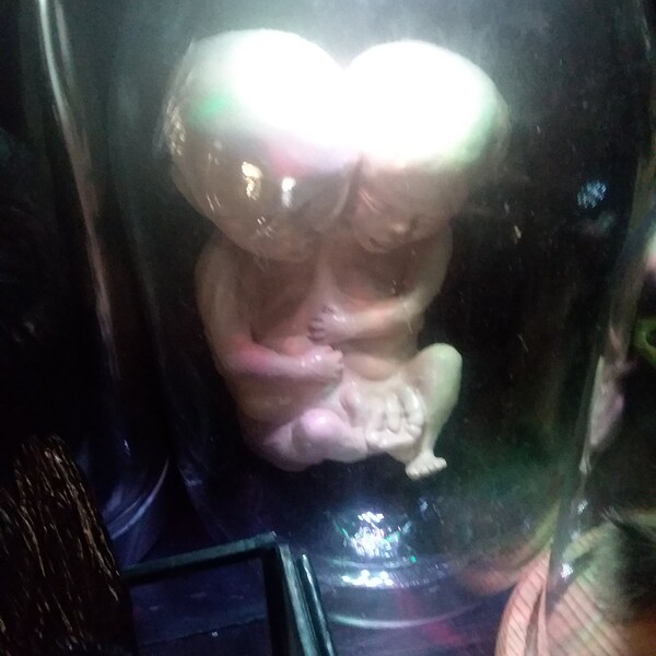 Plastic Replica Formaldehyde Skin Siamese Twin Fetus Baby Fetal ...