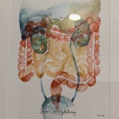 5-day Embryo Art Print Embryology Watercolor Print Fertility Doctor Art ...