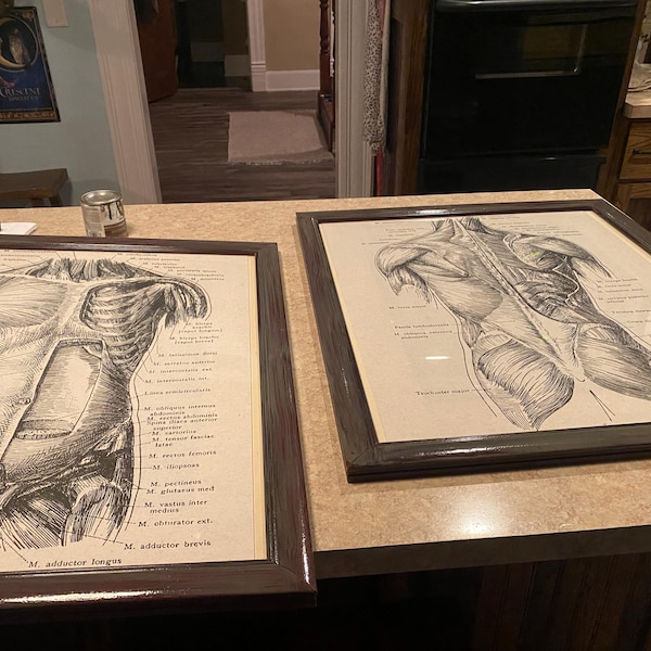 Human Anatomy Artworks | Medical Wall Pictures | Muscle Skeleton ...