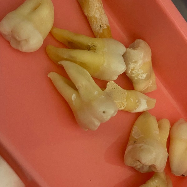 10 Real Human Teeth (molars, Premolars, & Anteriors) - Etsy